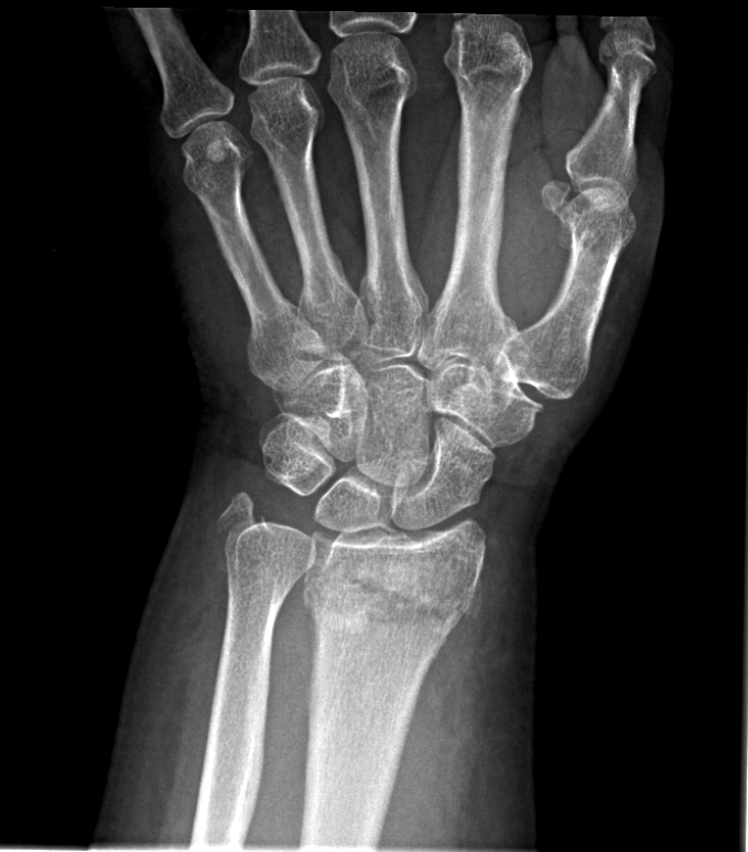 GitHub - UniData-pro/x-ray-of-upper-extremity-joints-dataset: The dataset of digital X-ray ...